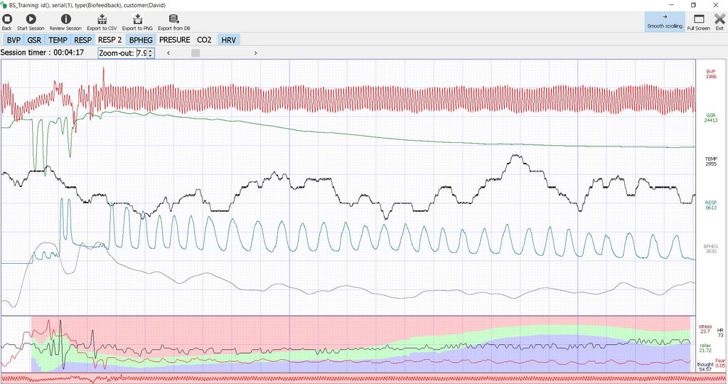 BioSignals AI-HRV smart finger sensor for clinic or home using by PC ...